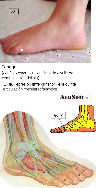 ABSCESOS Y FURUNCULOSIS